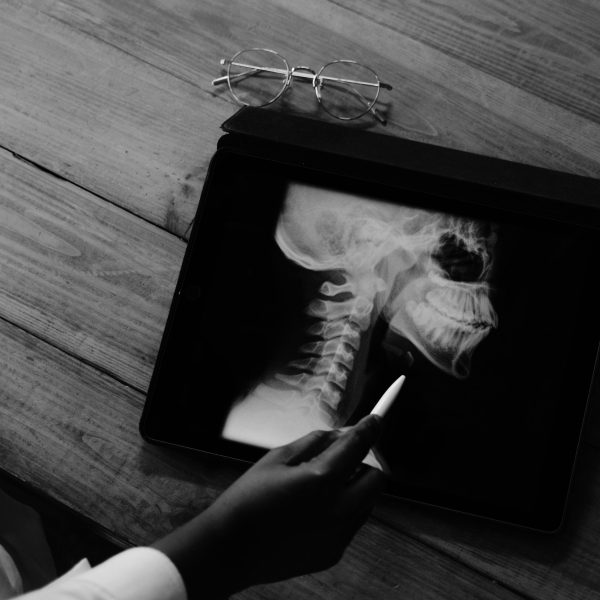 Coining: An Ancient Traditional Practice - INKspire